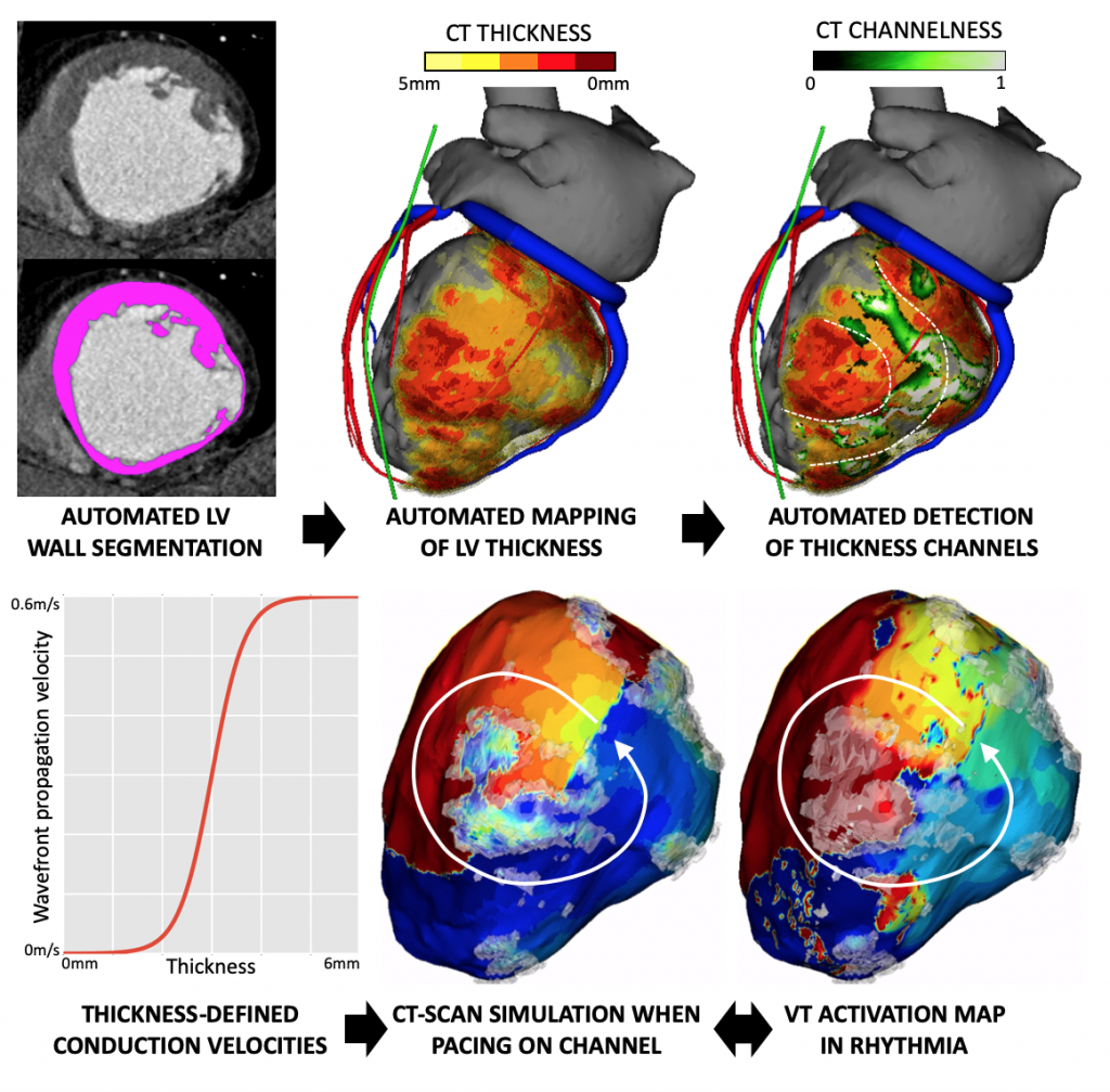 Computational Cardiology – Epione Computational Cardiology – Epione